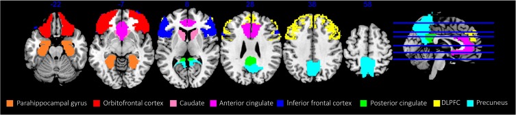 Video Game Addiction and the developing brain – Caronleid